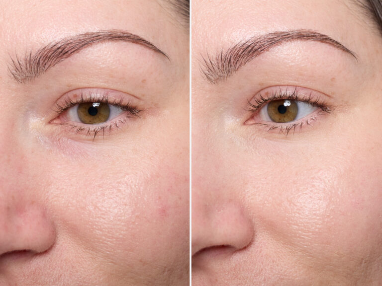 NYX Pro Fix Stick Concealer and Corrector Review - Coffee & Makeup